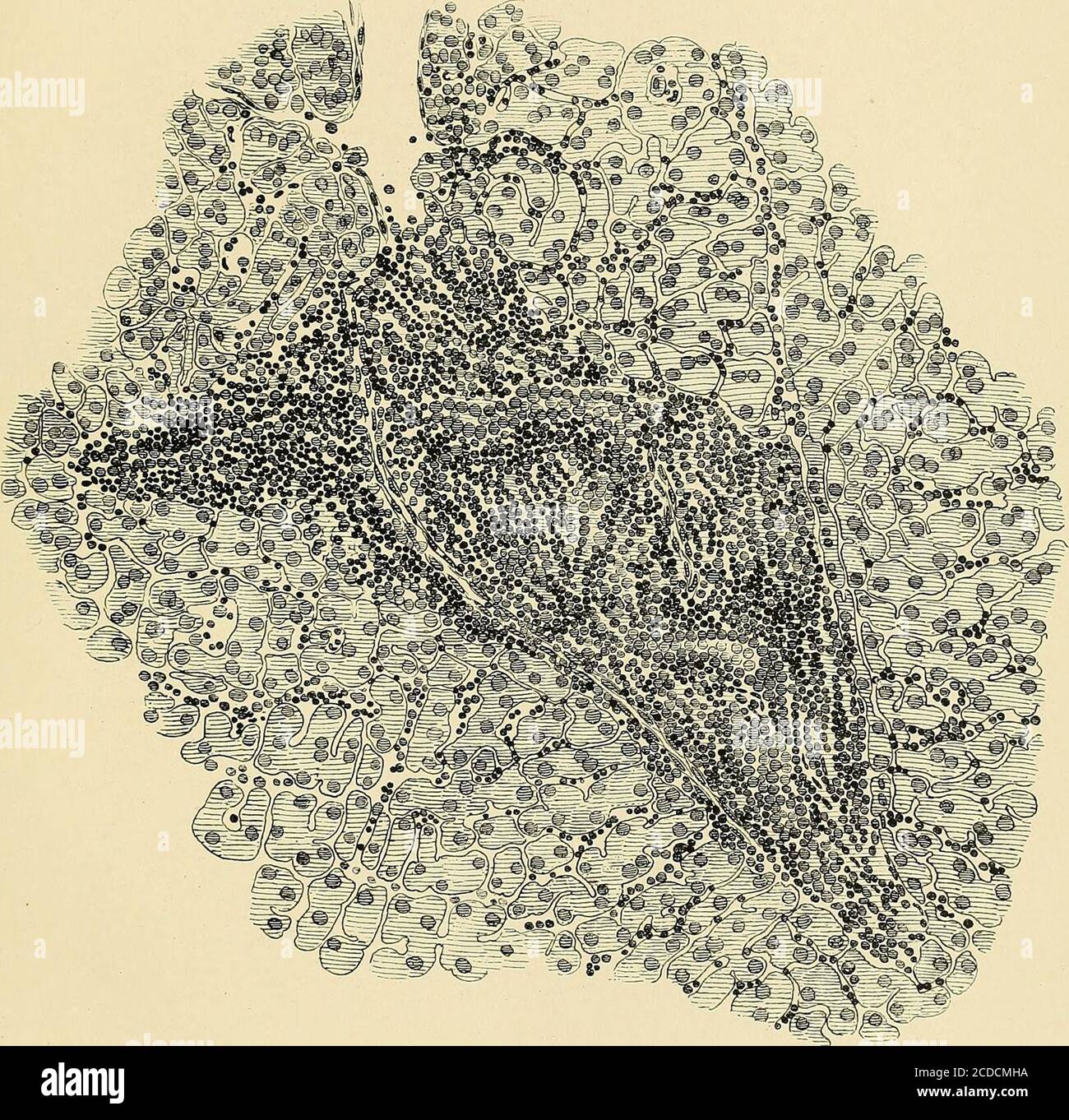 . A study of some fatal cases of malaria . ccumulation ; distortion and ...