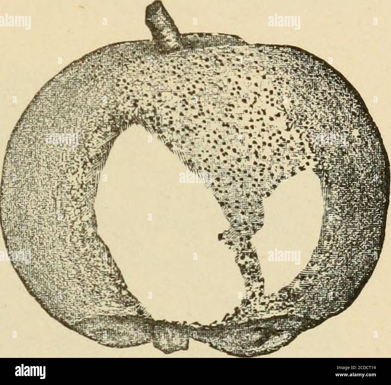 Black pustules hi-res stock photography and images - Alamy