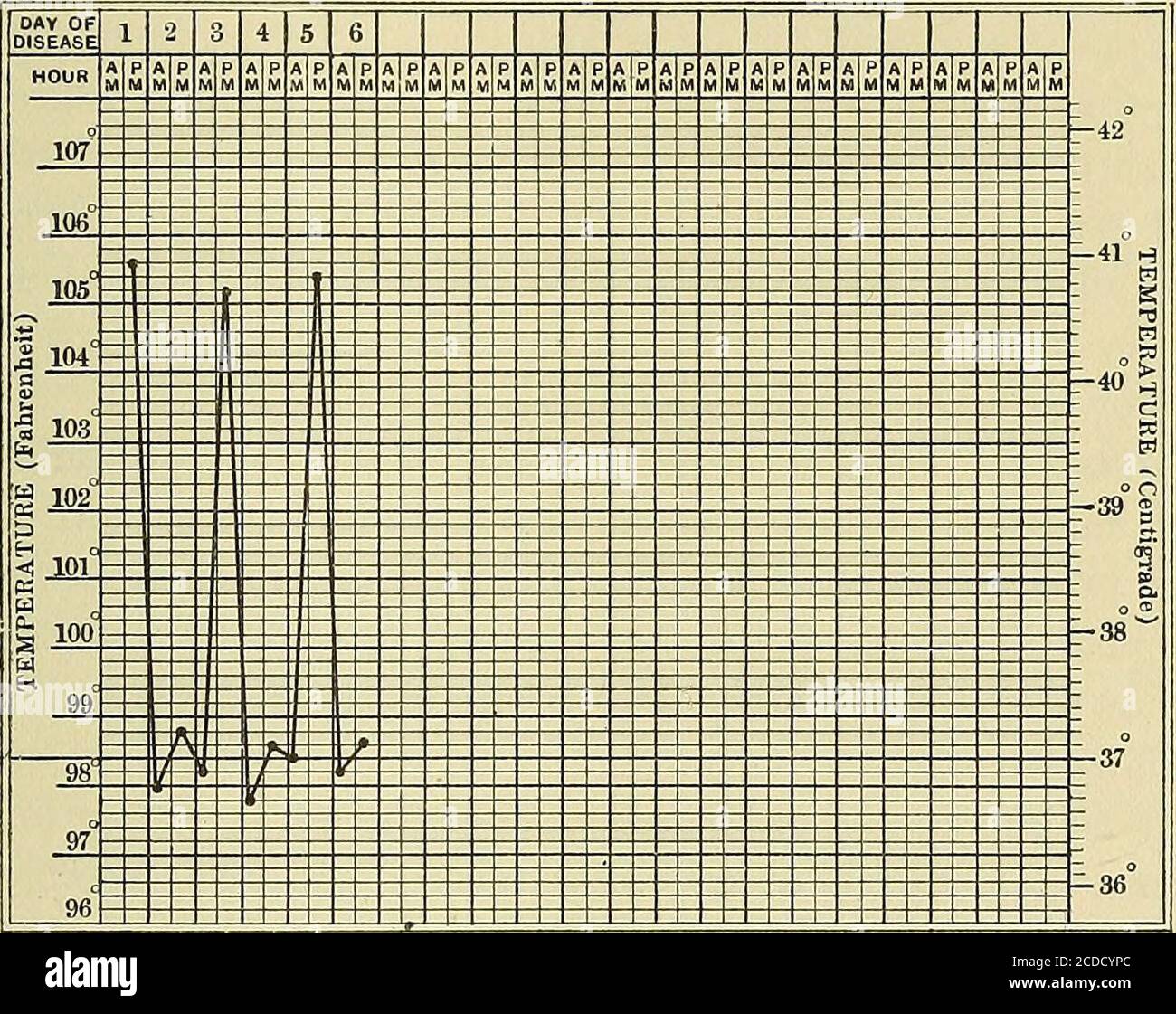 Prodromal hi-res stock photography and images - Alamy