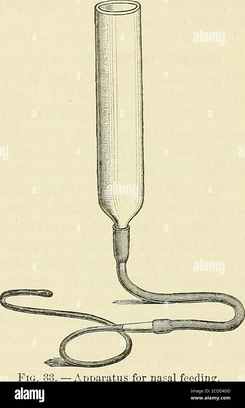 . A system of medicine, by many writers; . Pig. 32. — Feeding-cup with ...