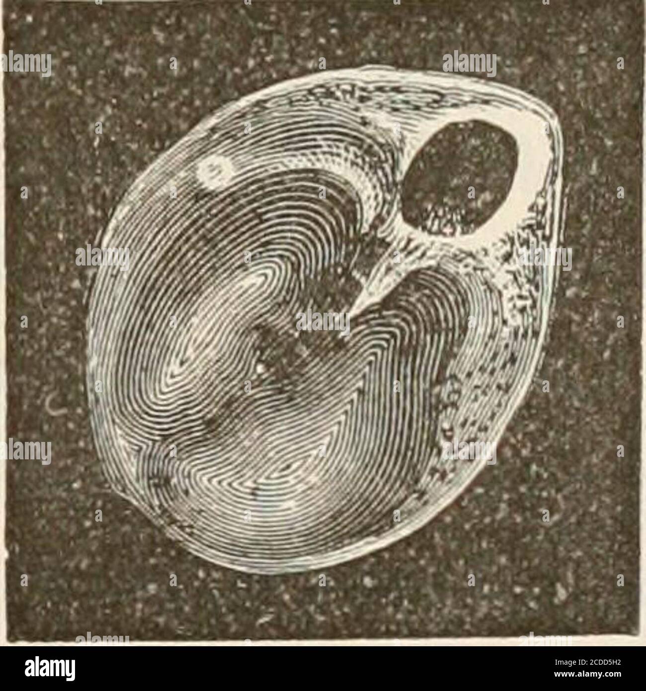 Tendinous ring hi-res stock photography and images - Alamy