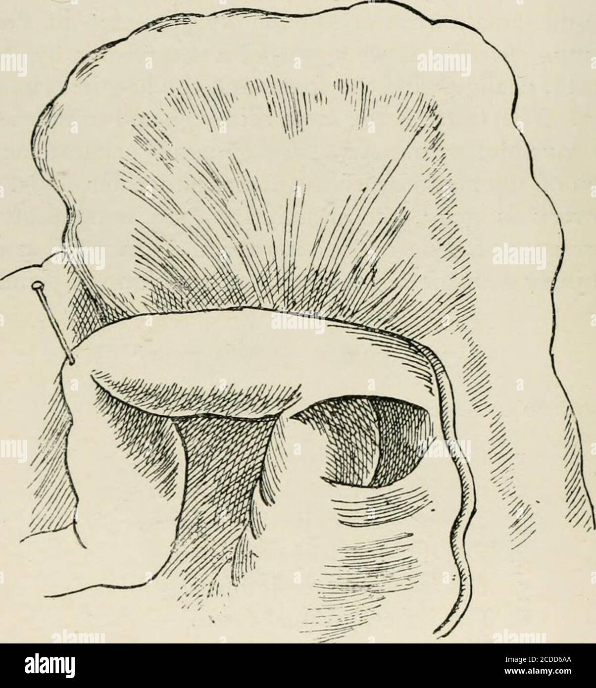 . On retro-peritoneal hernia . 6. The infra-duodenal fossa. 7. The para ...
