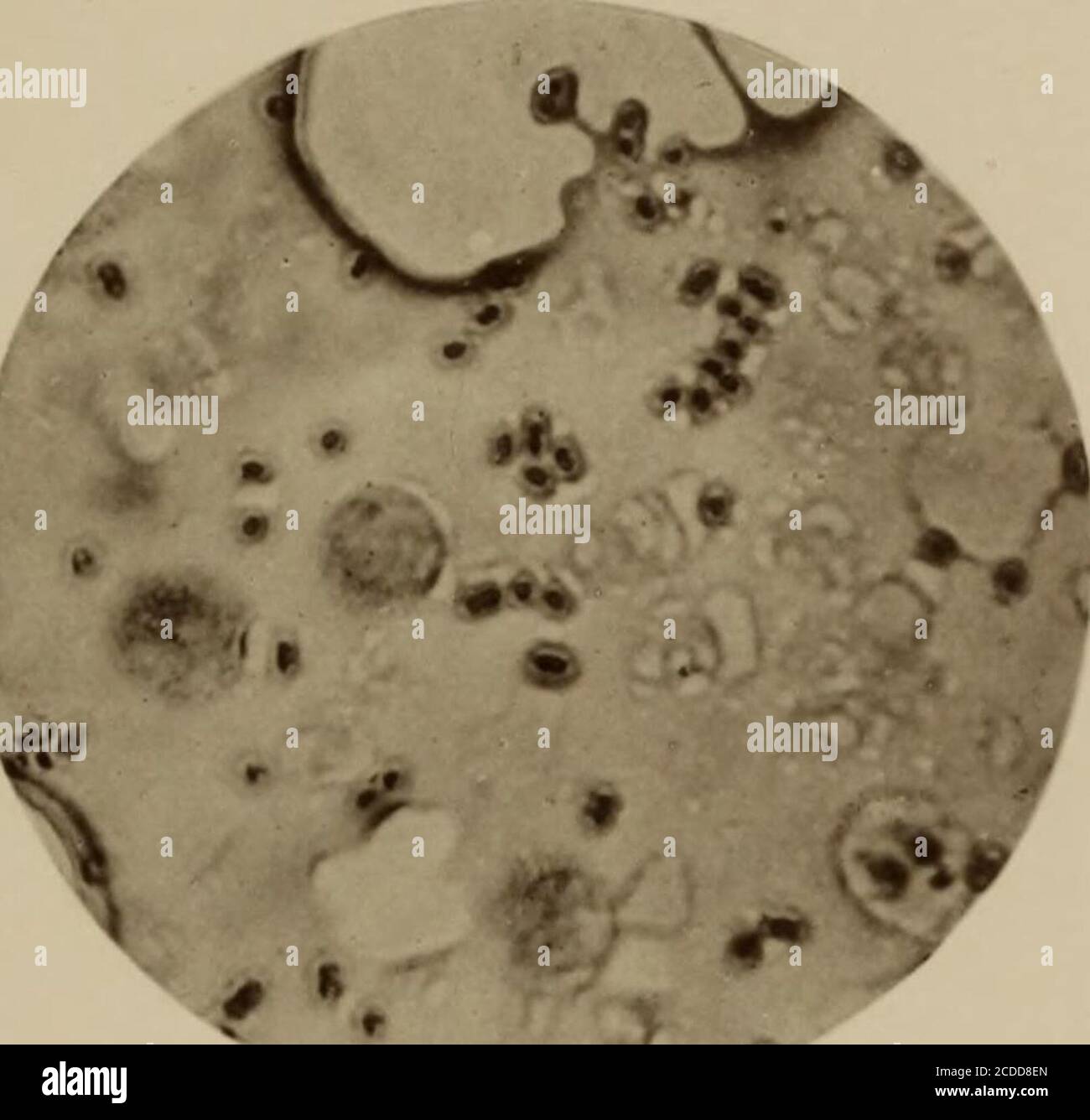 Bacillus anthracis capsule hi-res stock photography and images - Alamy