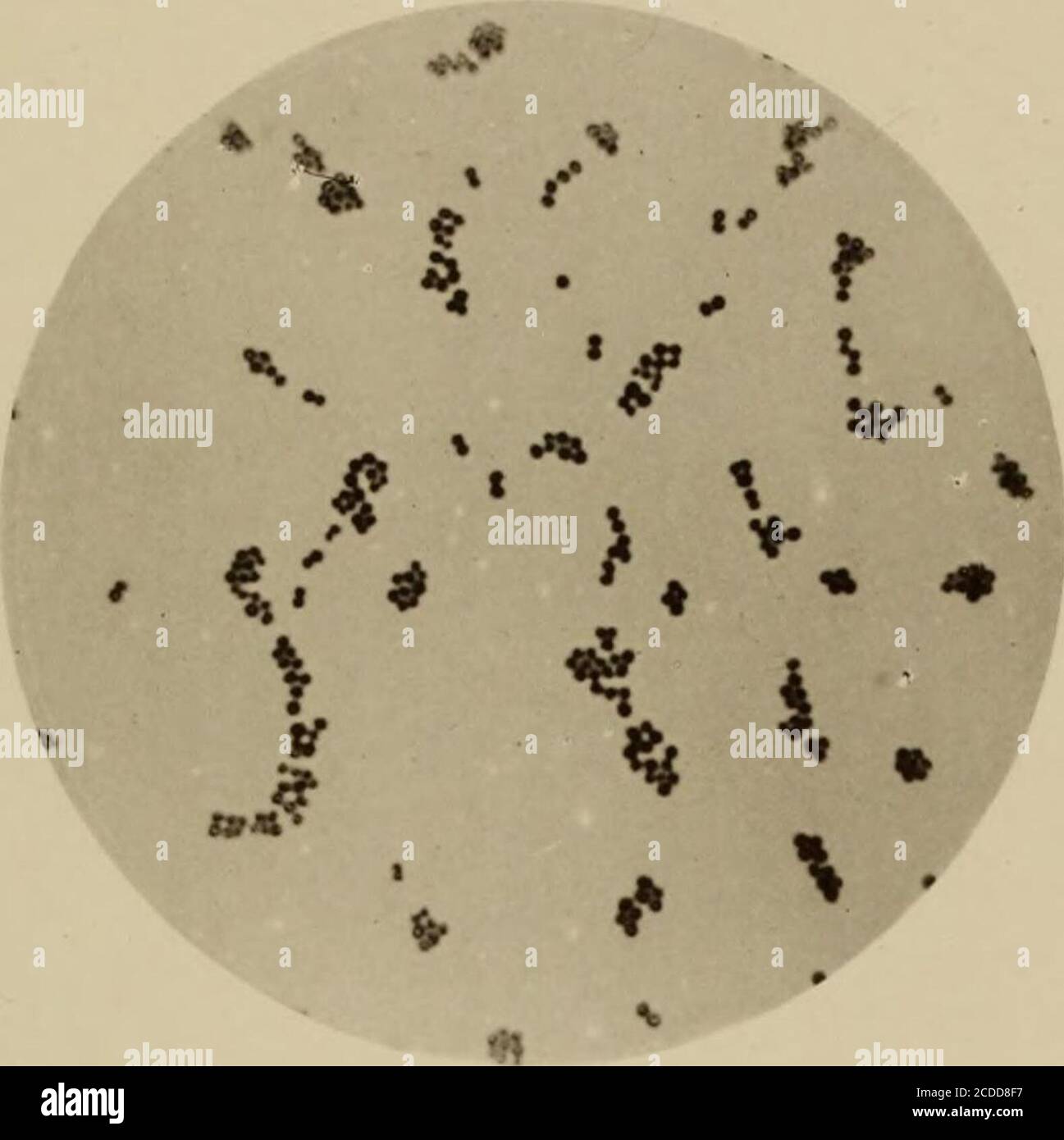 Xeroderma Pigmentosum Histology