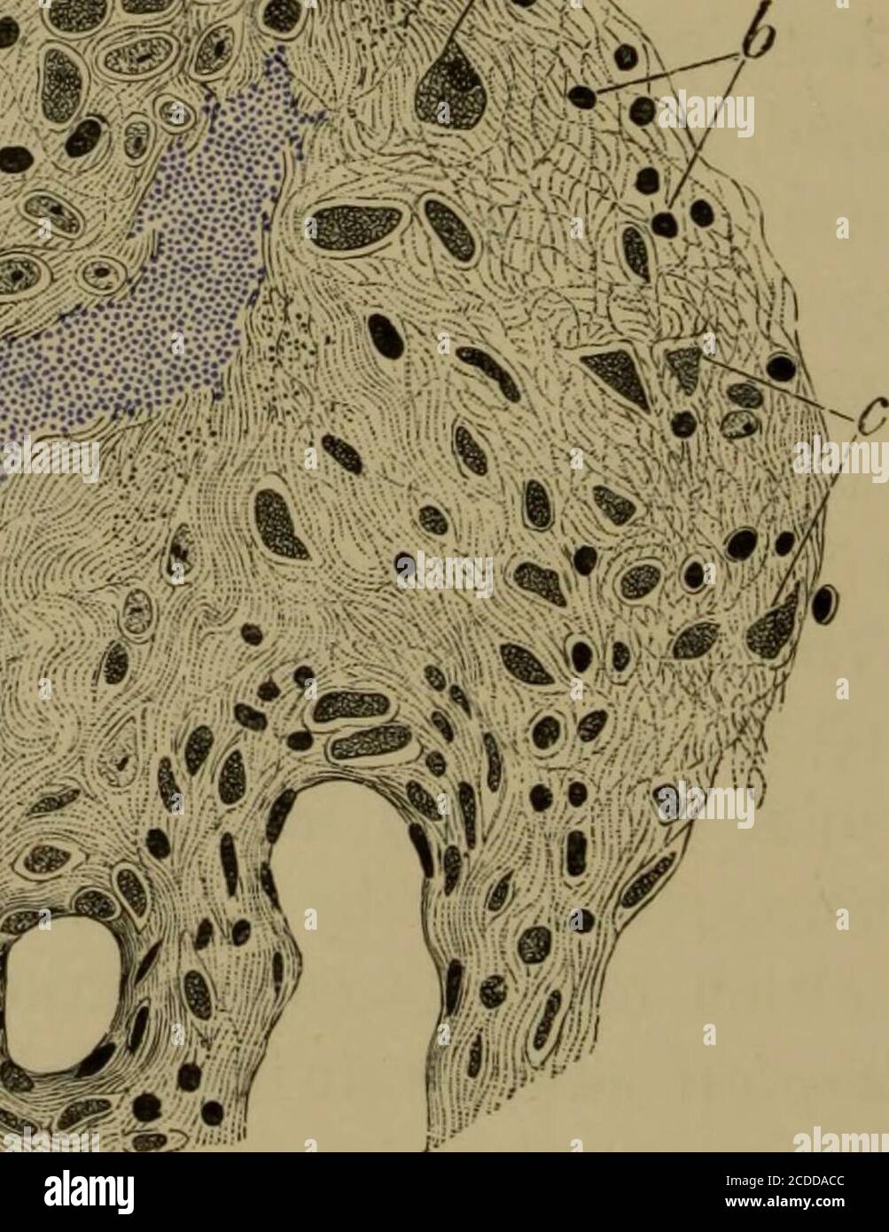 Poly Mononuclear Cells