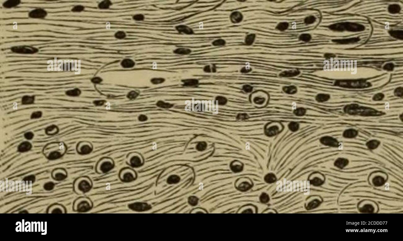 Intima layer hi-res stock photography and images - Alamy