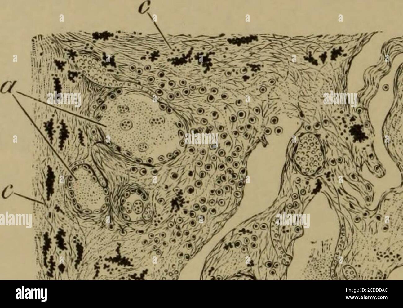 Caseation High Resolution Stock Photography and Images - Alamy