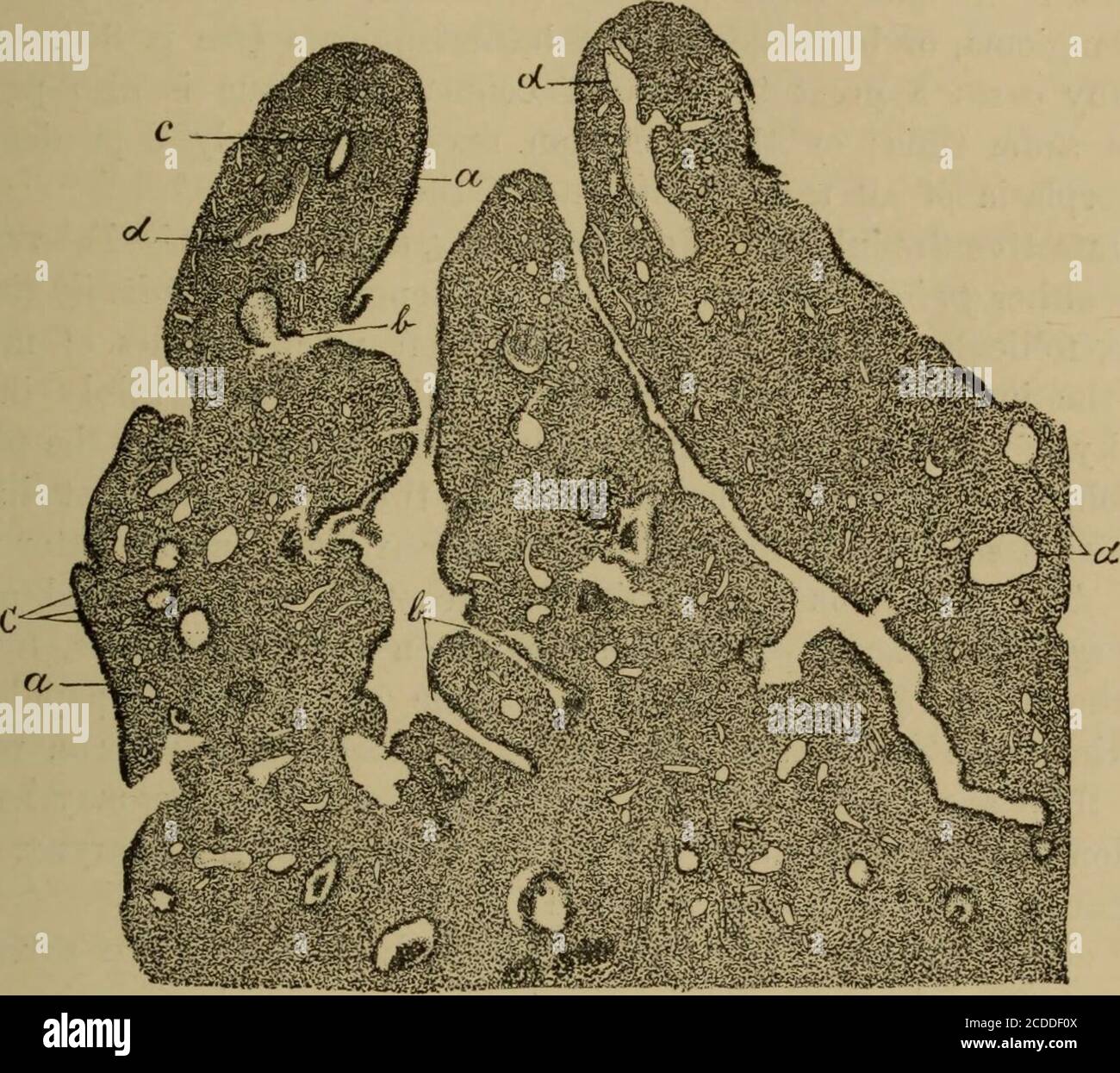 Adenoid tissue hi-res stock photography and images - Alamy
