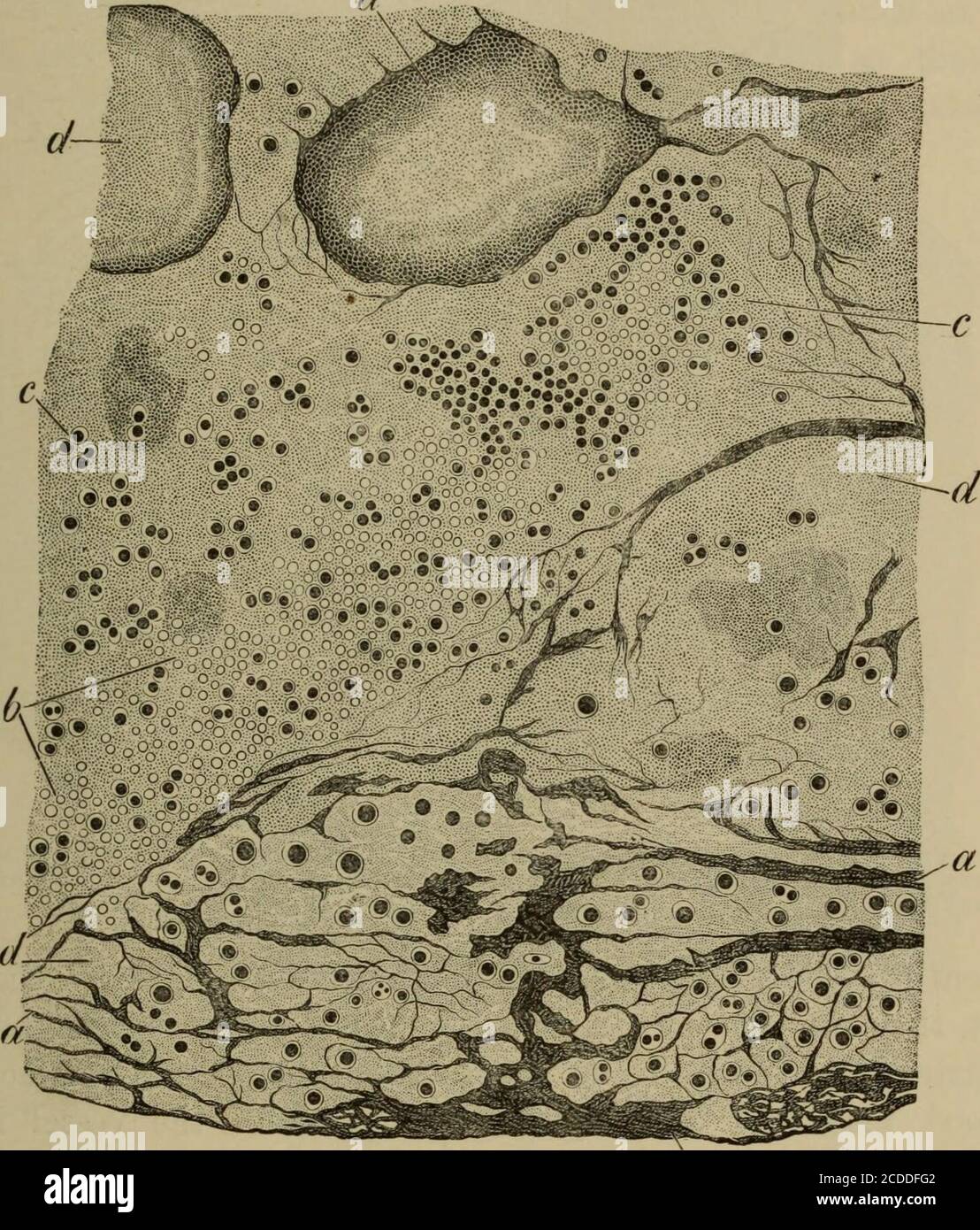 Fibrin Histology