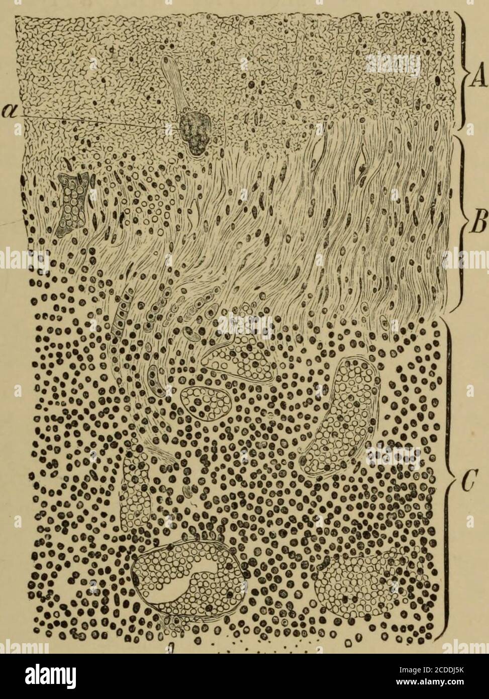 Hard chancre hi-res stock photography and images - Alamy