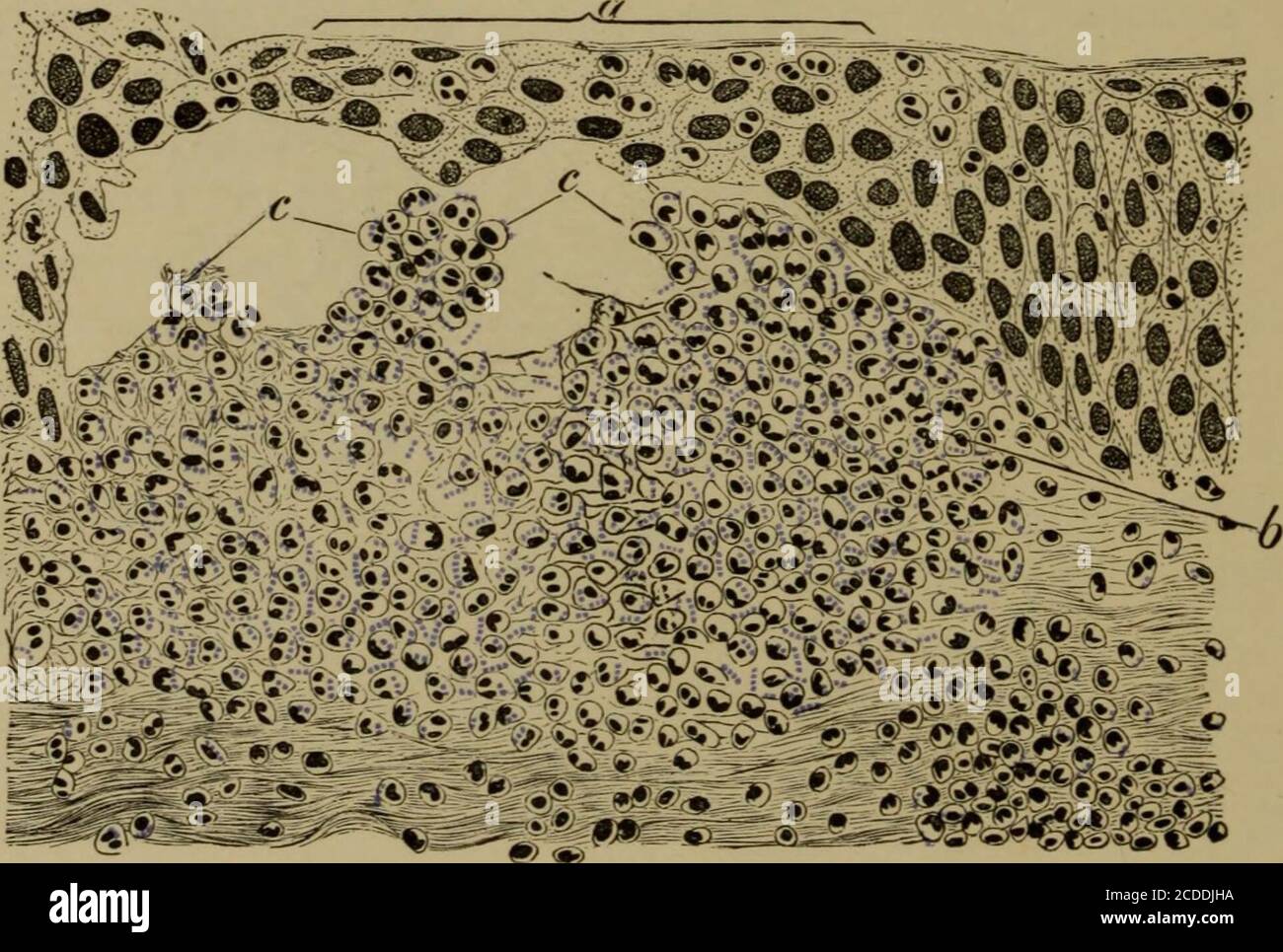 Special pathological anatomy hi-res stock photography and images - Alamy