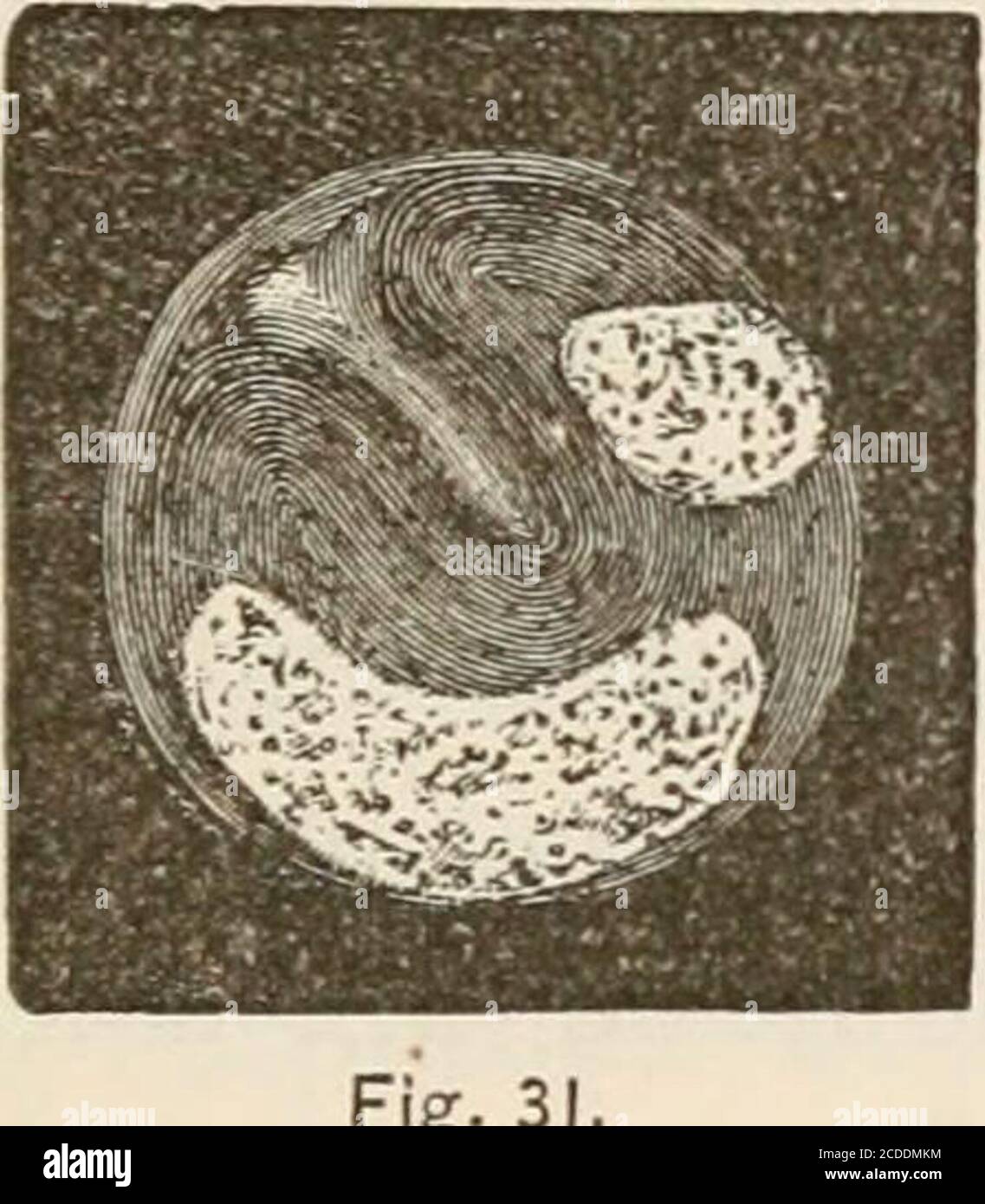 . The pathological anatomy of the ear . a, which fibres are, in the ...