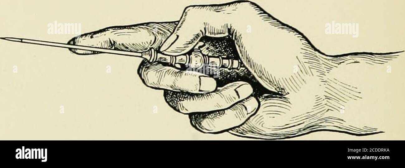 . The practice of anæsthetics . Fig. 59.—Trocar and cannula with side ...