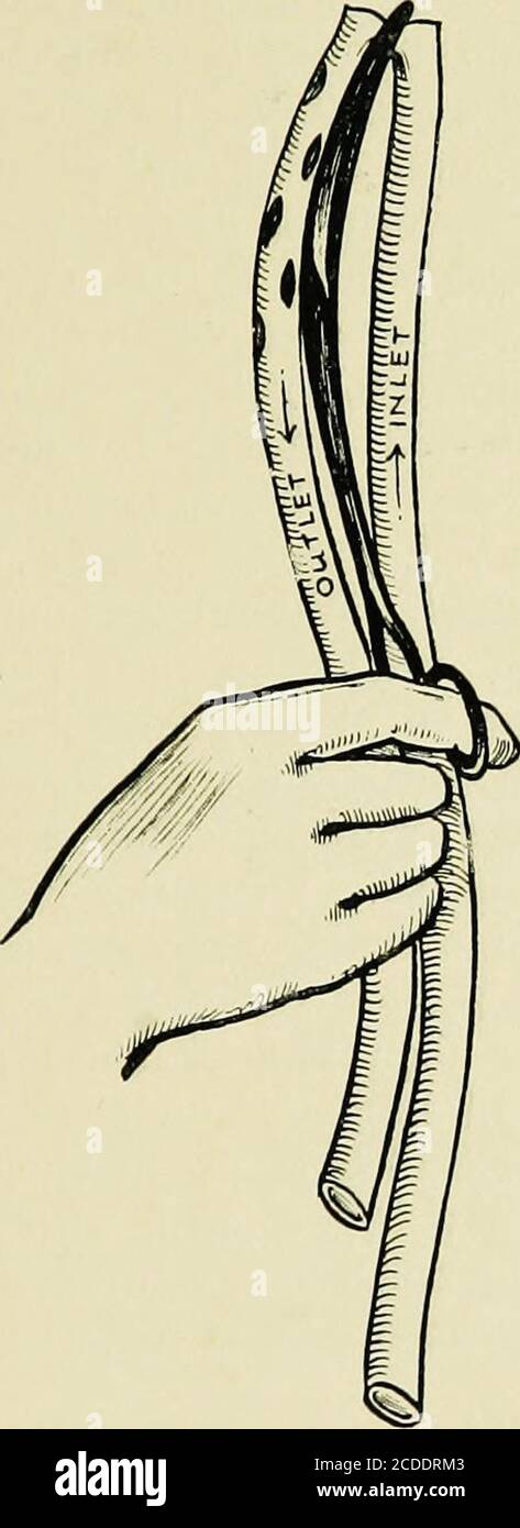 Subcutaneous suture hi-res stock photography and images - Alamy