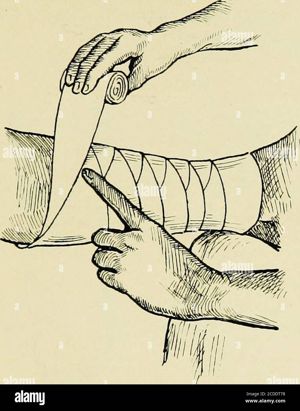 . The practice of anæsthetics . Fig. 46.—Spica of hip or groin ...