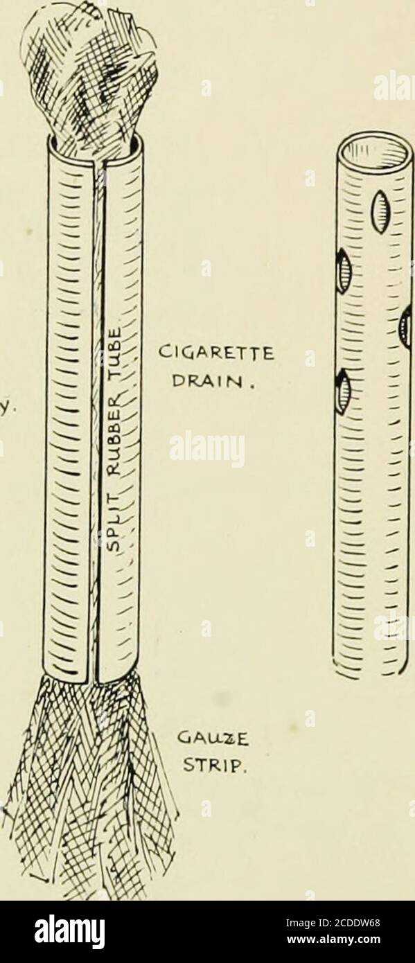 . The practice of anæsthetics . -— y — > ^ >; FOR. IMMEDIATEDRAINAGE ...