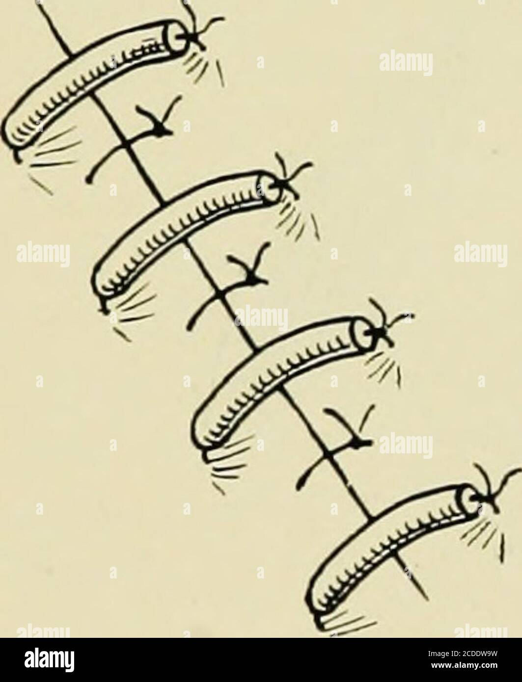 Sepsis Skin High Resolution Stock Photography and Images - Alamy