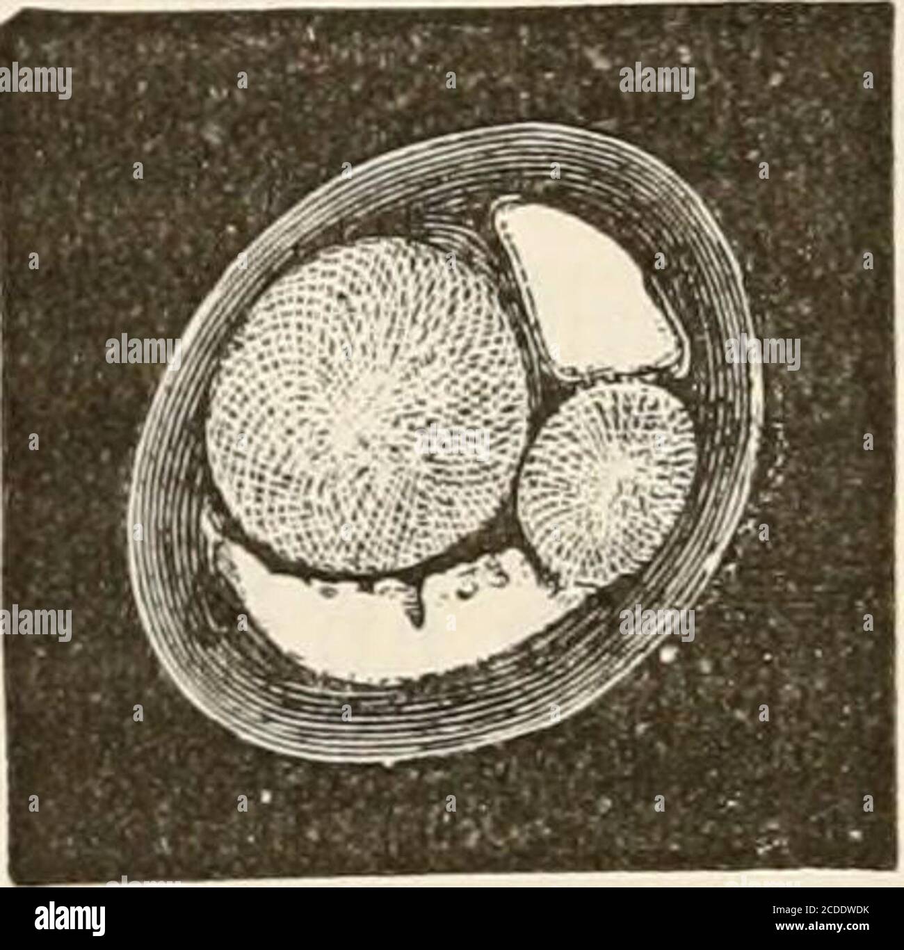 . The pathological anatomy of the ear . Fig. 28. Exostoses on the ...