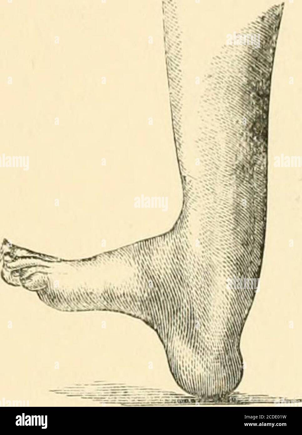 . The surgical treatment of the common deformities of children . or ...
