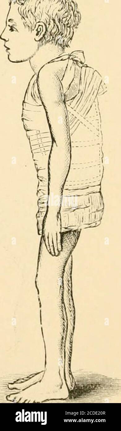 . The surgical treatment of the common deformities of children . big ...