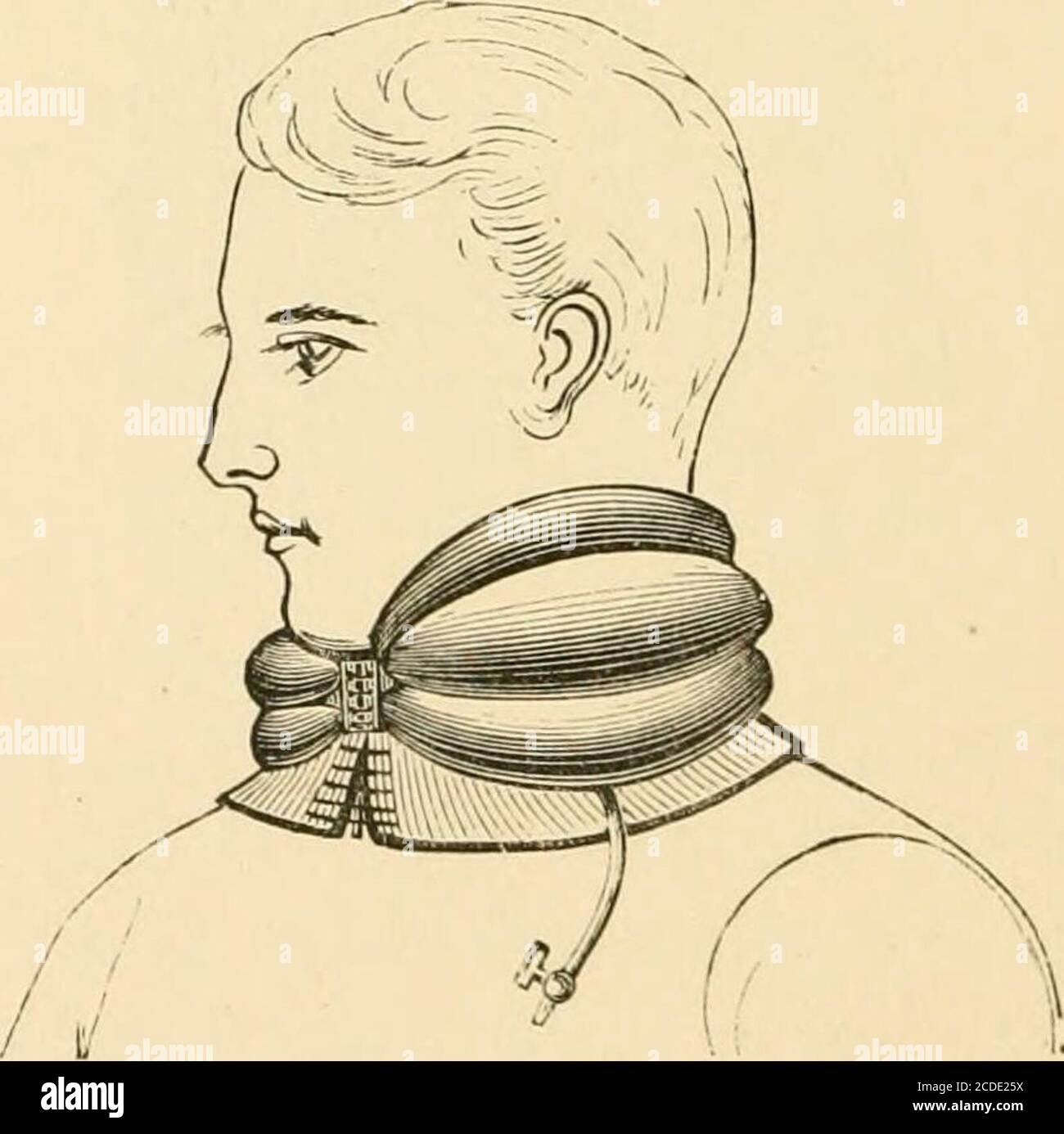 Head deformities children hi-res stock photography and images - Alamy