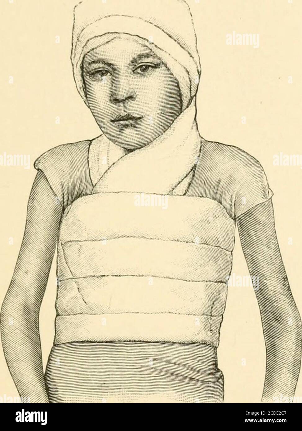 Head deformities children hi-res stock photography and images - Alamy