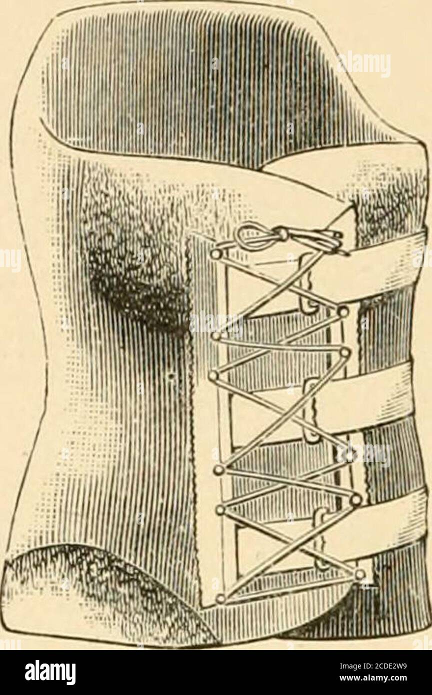 . The surgical treatment of the common deformities of children . erthan ...
