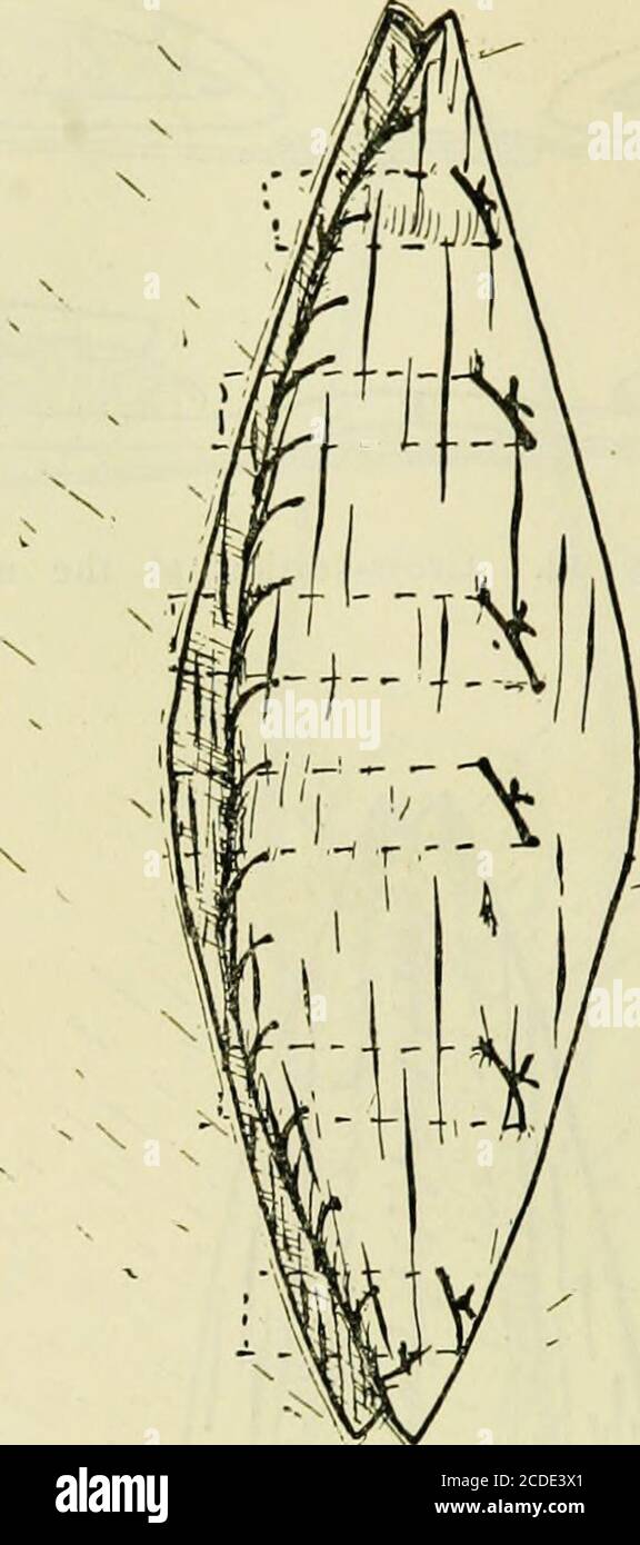 . Proceedings of the Connecticut State Medical Society .. . Fig. 16 ...