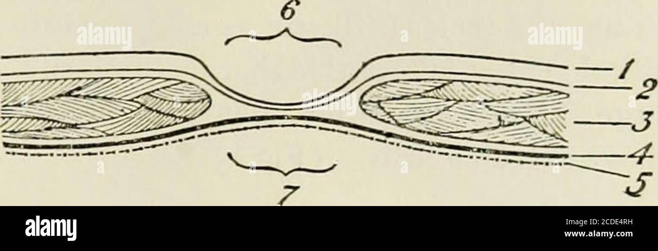 Umbilical Vein High Resolution Stock Photography and Images - Alamy