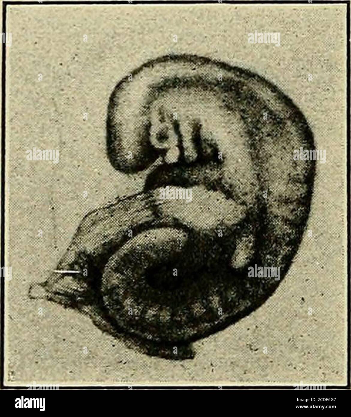. A study of the causes underlying the origin of human monsters : third ...