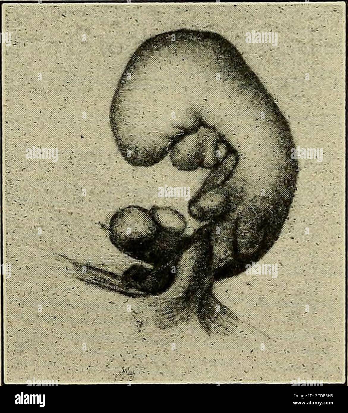 . A study of the causes underlying the origin of human monsters : third ...
