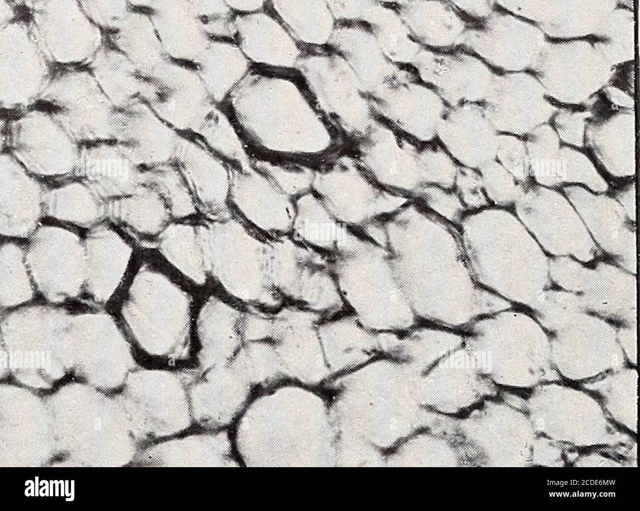 . The structure and development of crown gall : a plant cancer Stock ...