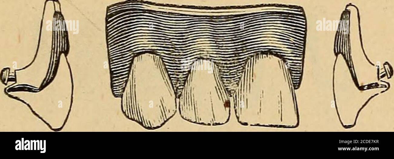 Flattened arch hi-res stock photography and images - Alamy