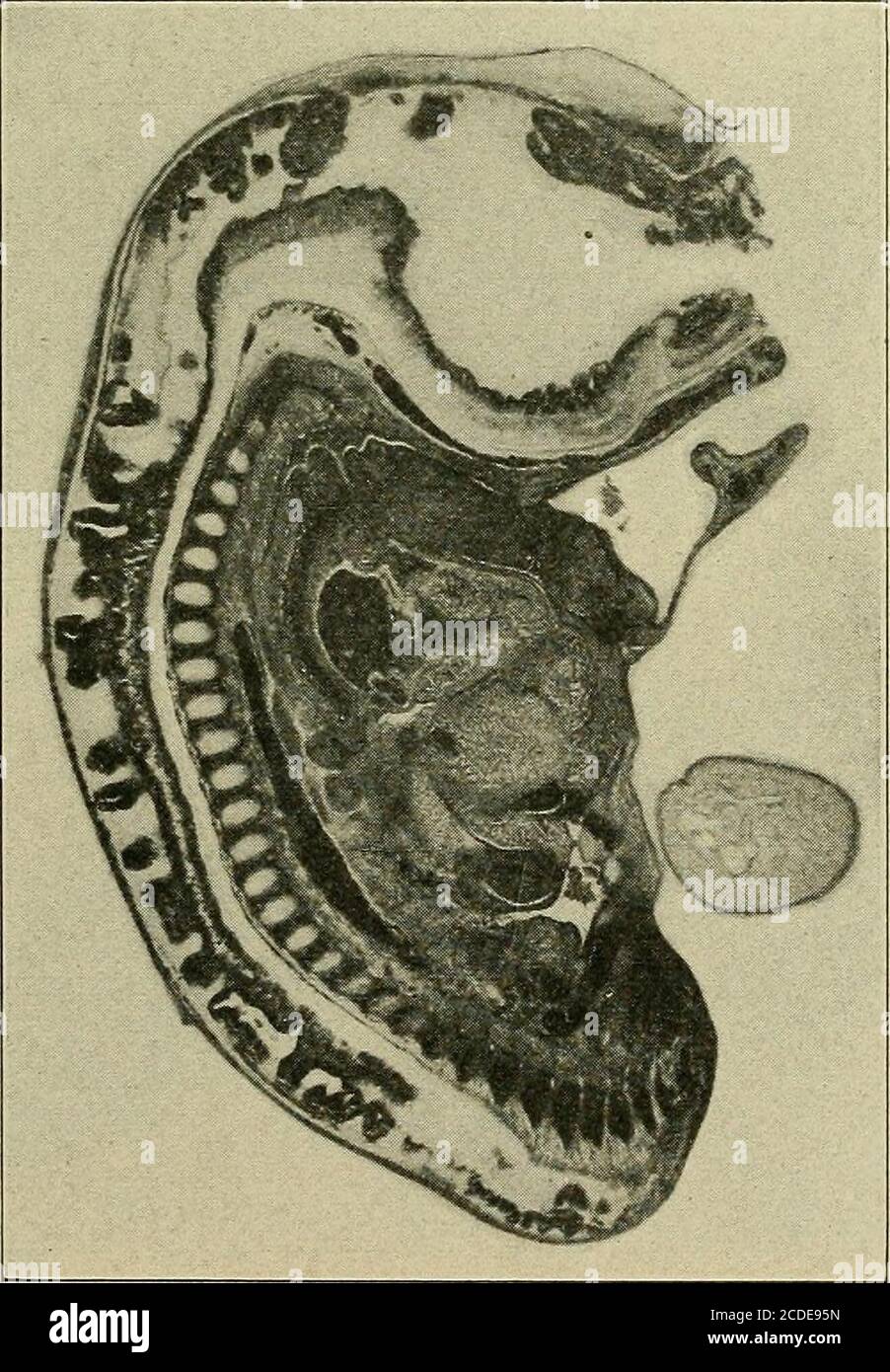 . A study of the causes underlying the origin of human monsters : third ...