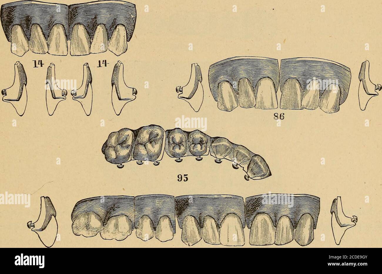 Maxillary arch hi-res stock photography and images - Alamy