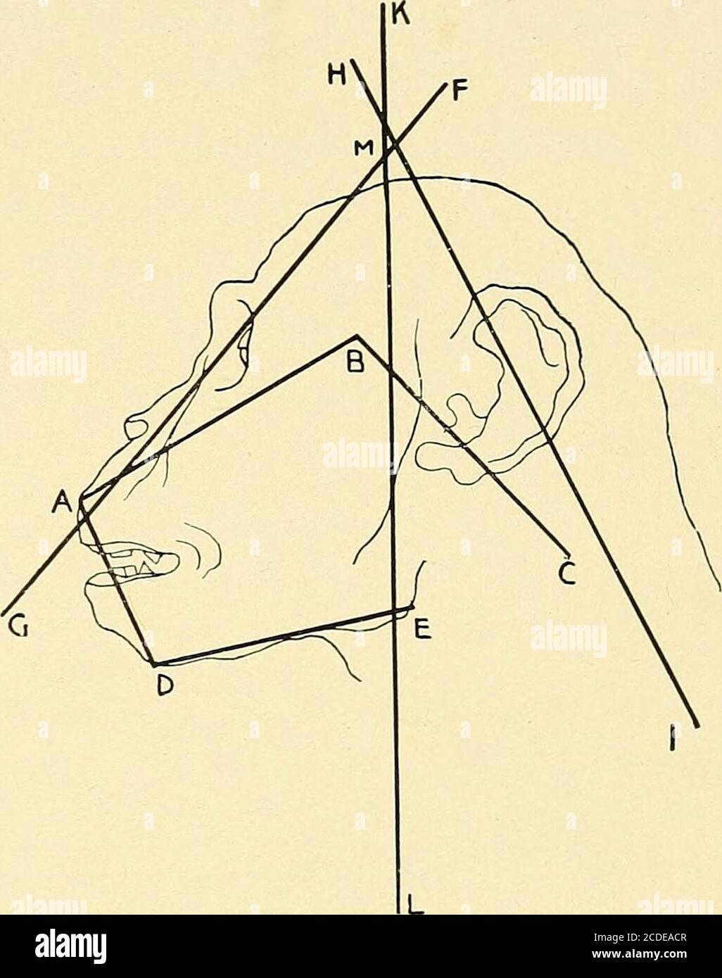 Cranial lines hi-res stock photography and images - Alamy