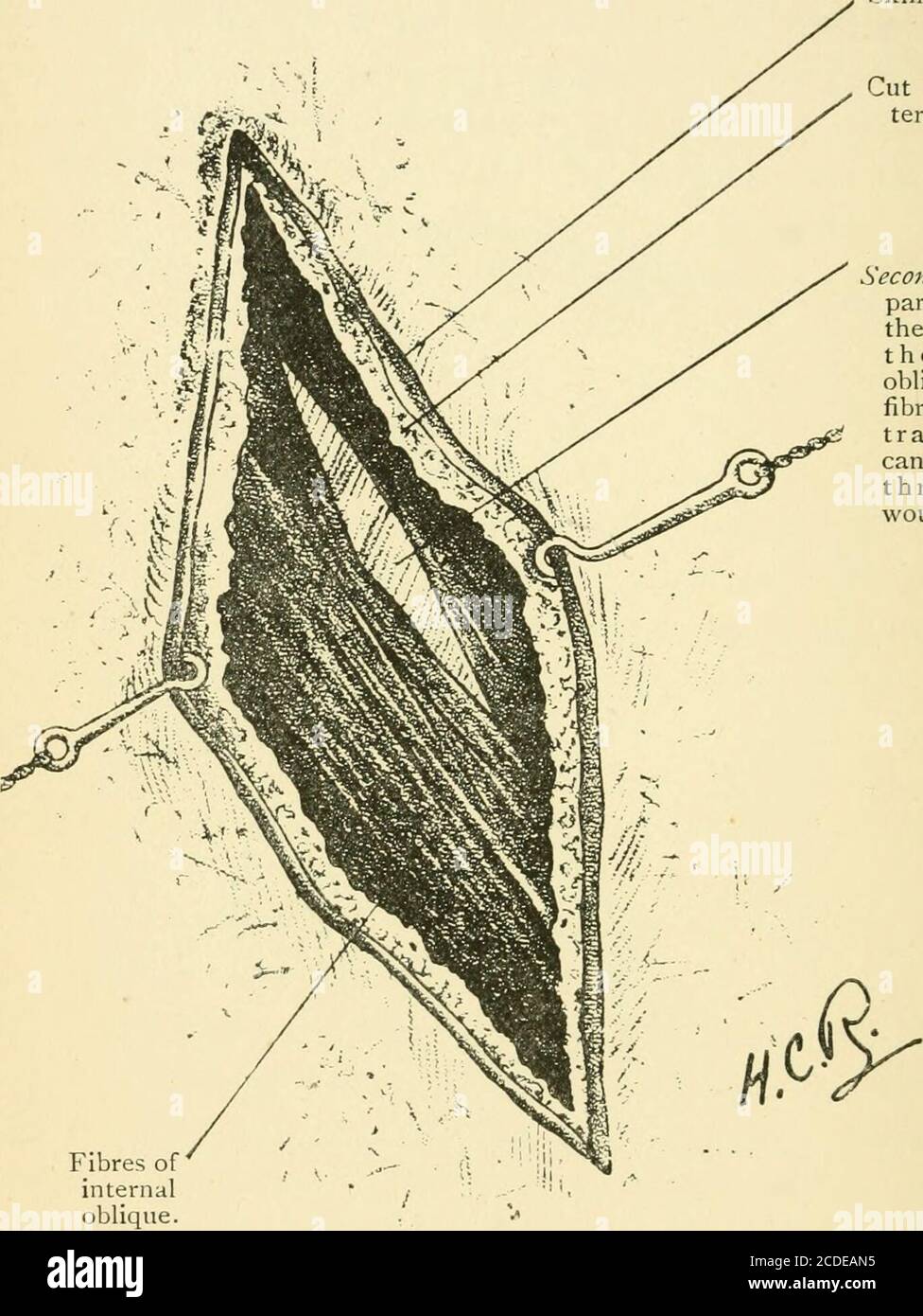 . The common colics of the horse : their causes, symptoms, diagnosis ...