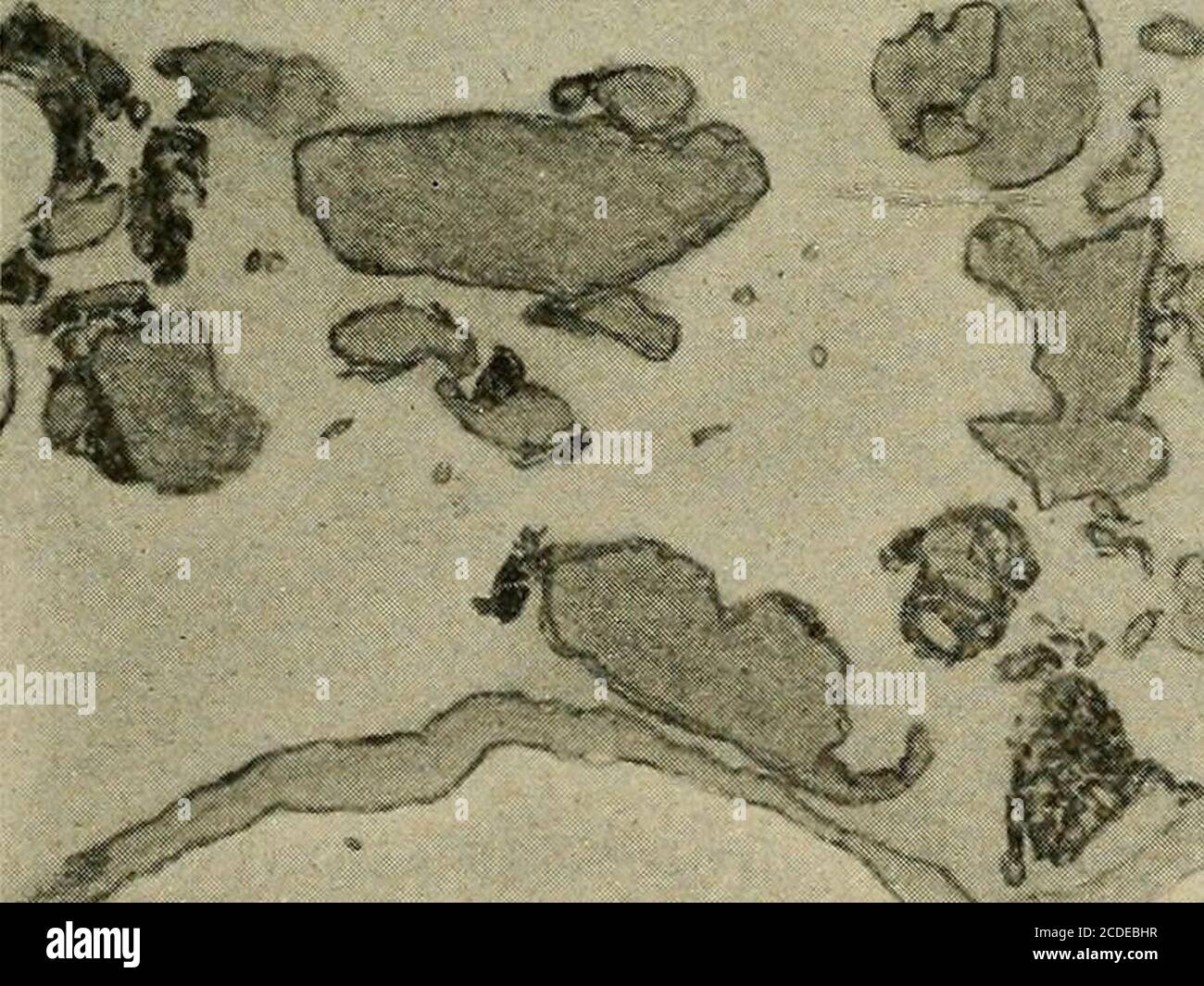 Human embryo tail hi-res stock photography and images - Alamy