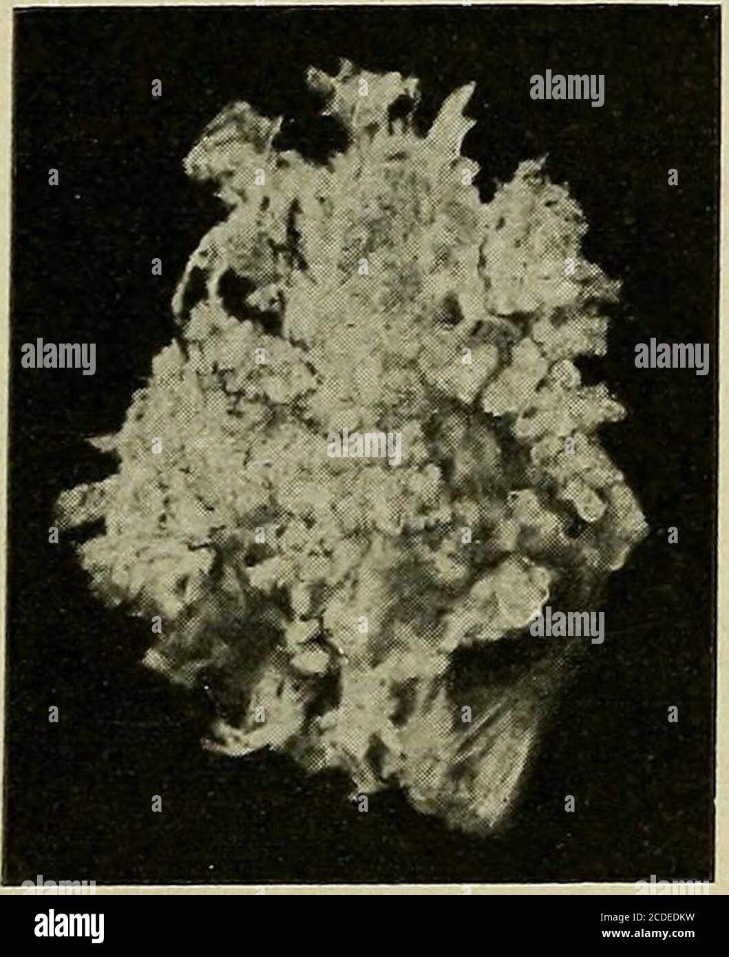 Human embryo showing eye hi-res stock photography and images - Alamy