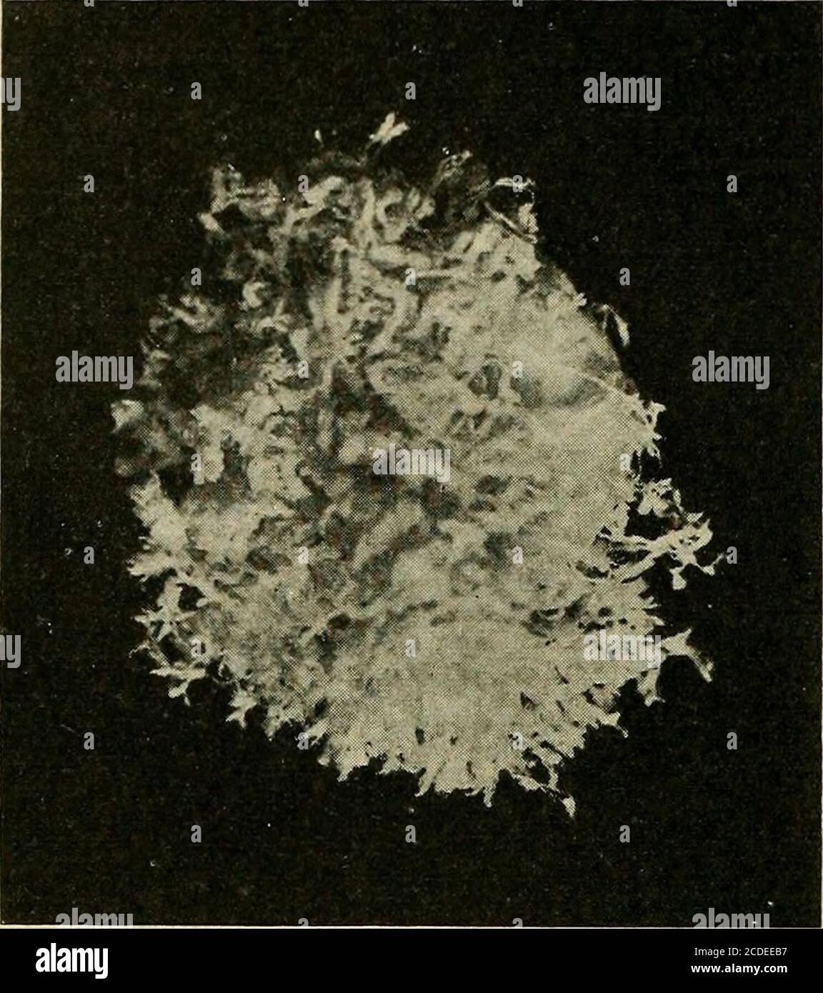 Bloody placenta hi-res stock photography and images - Alamy