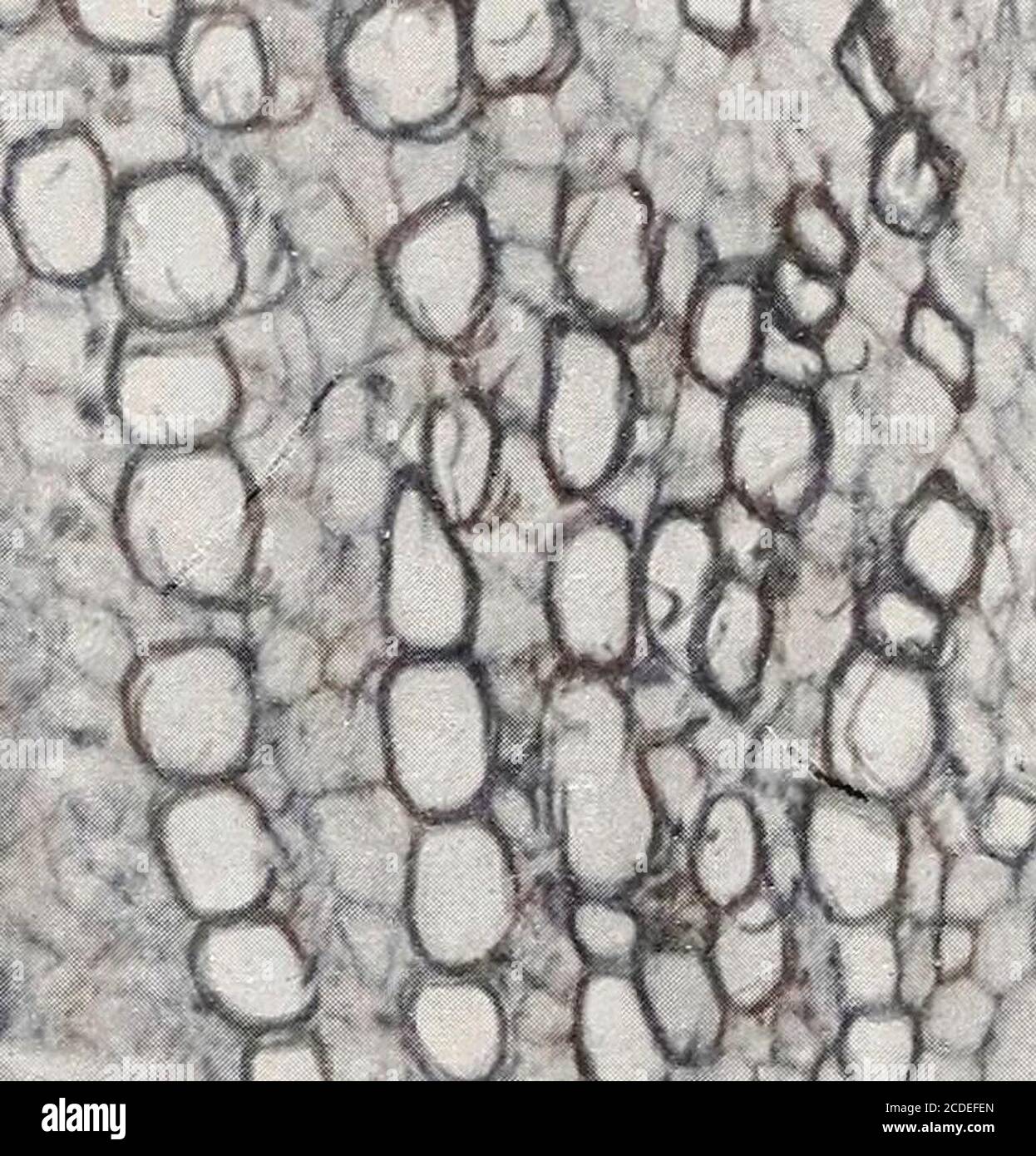 . The structure and development of crown gall : a plant cancer . s anM ...