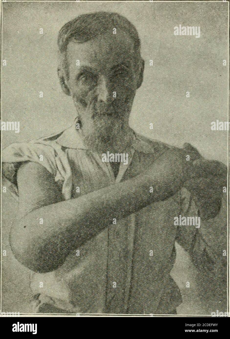 Partial projection hi-res stock photography and images - Alamy