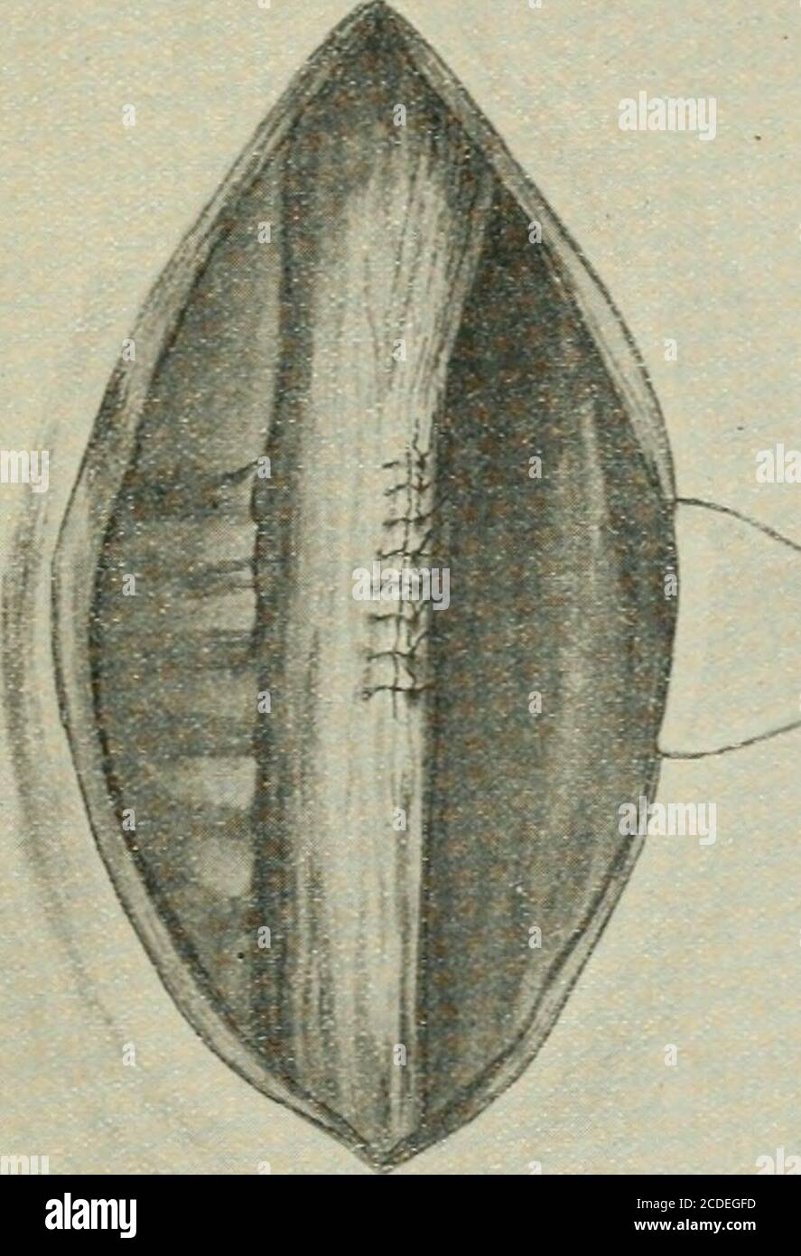 Inverted pouch hi-res stock photography and images - Alamy