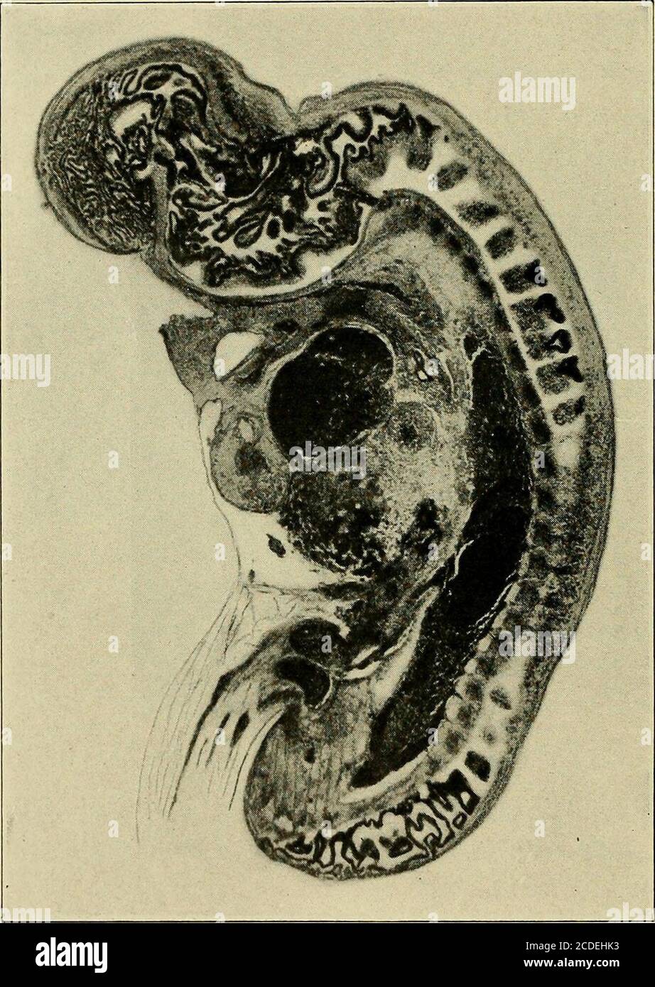 . A study of the causes underlying the origin of human monsters : third ...