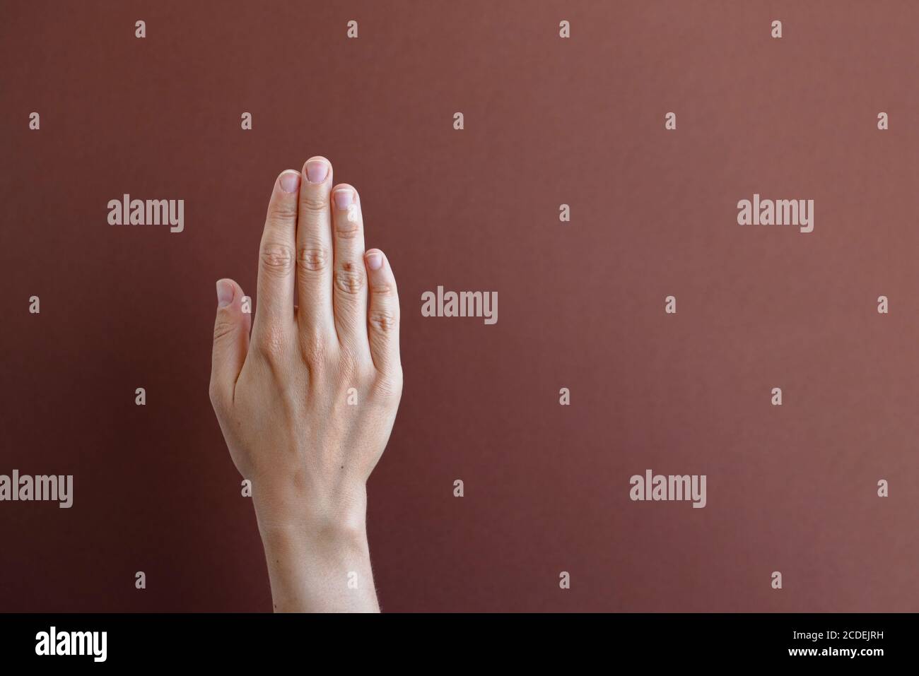 Birthmark woman hi-res stock photography and images - Alamy