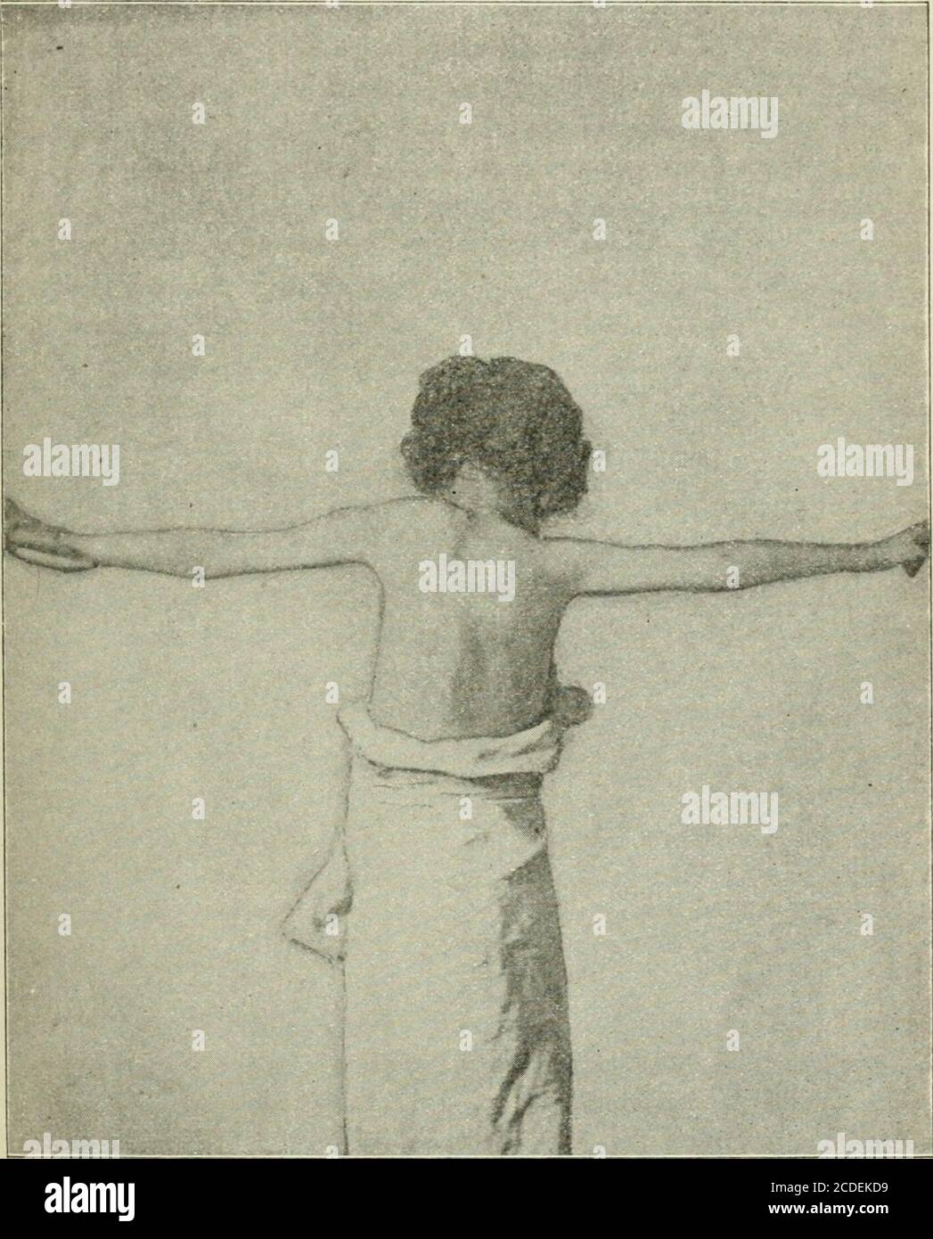 Cervical incision hi-res stock photography and images - Alamy