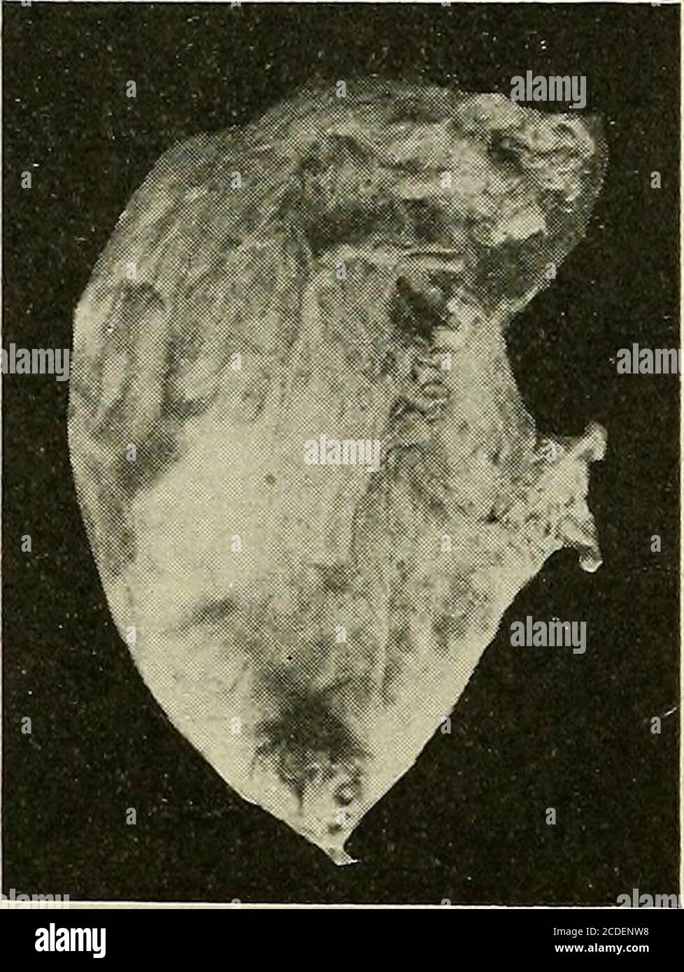 30 old embryo hi-res stock photography and images - Alamy