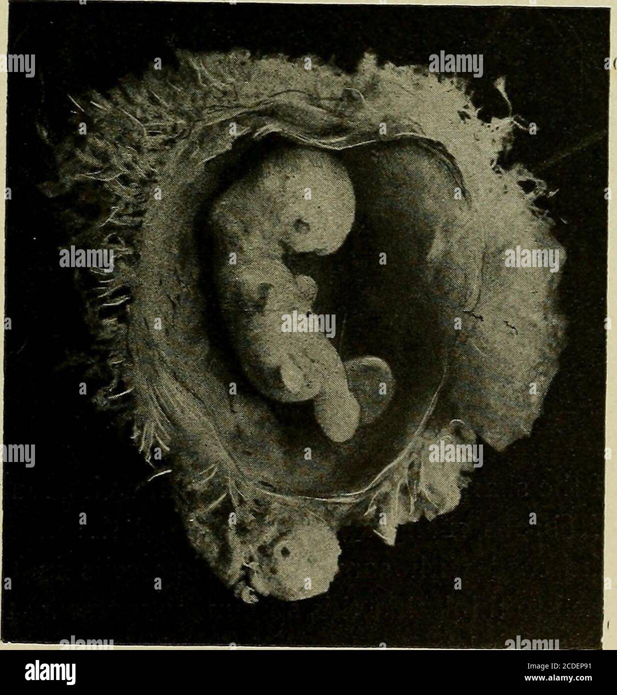 Necrotic embryo hi-res stock photography and images - Alamy
