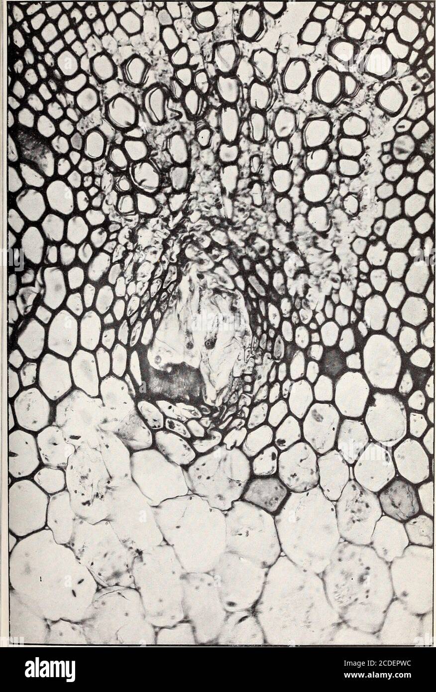 . The structure and development of crown gall : a plant cancer . Daisy ...