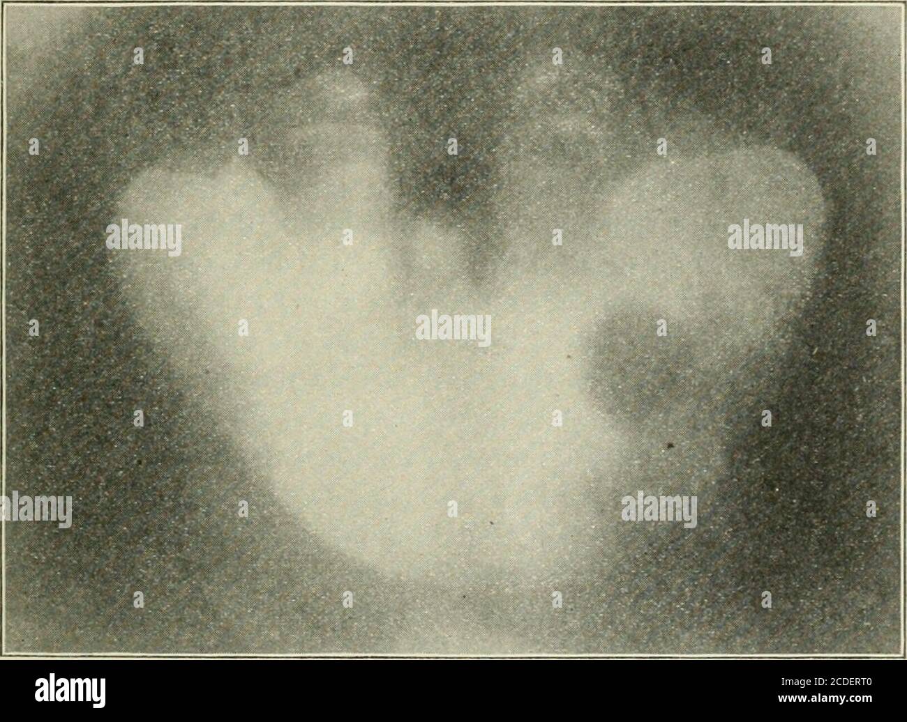 . Annals of surgery . ed, and practically in our hands, we can fix ...